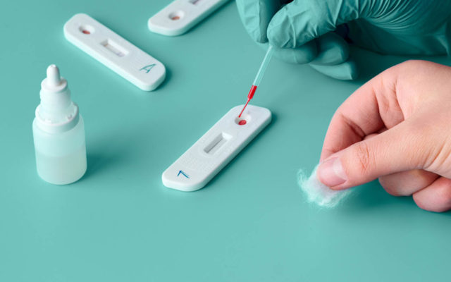Where to Go for a COVID-19 PCR Test in Ras Al Khaimah - MyBayut